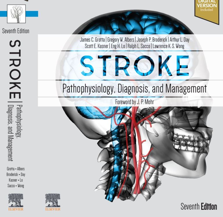 Stroke: Pathophysiology, Diagnosis, and Management – Penn Neurology ...